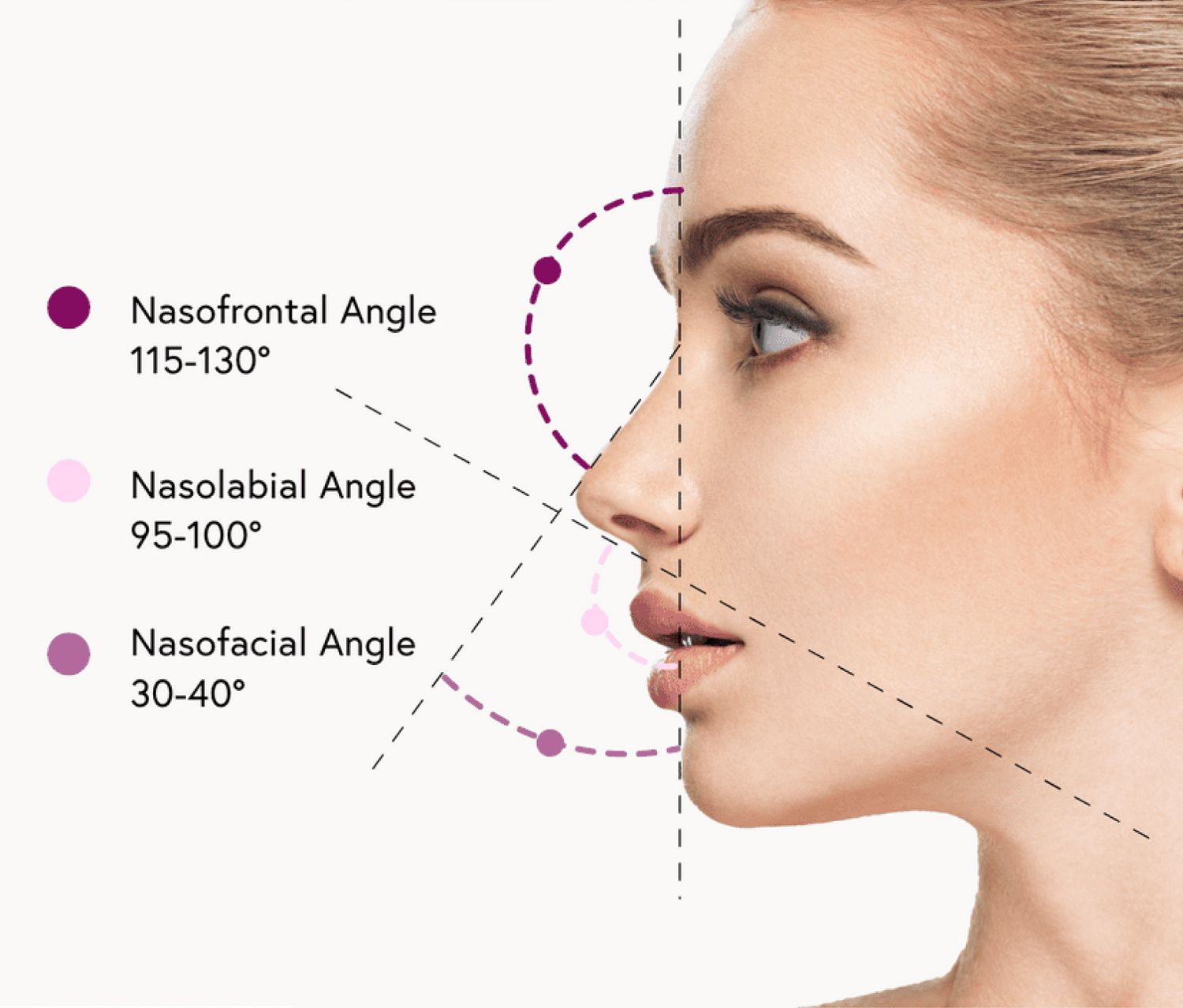 Open vs Closed Rhinoplasty | What's the difference?